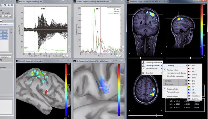 Brainstorm Matlab Open Source Application For Meg Eeg Data Analysis