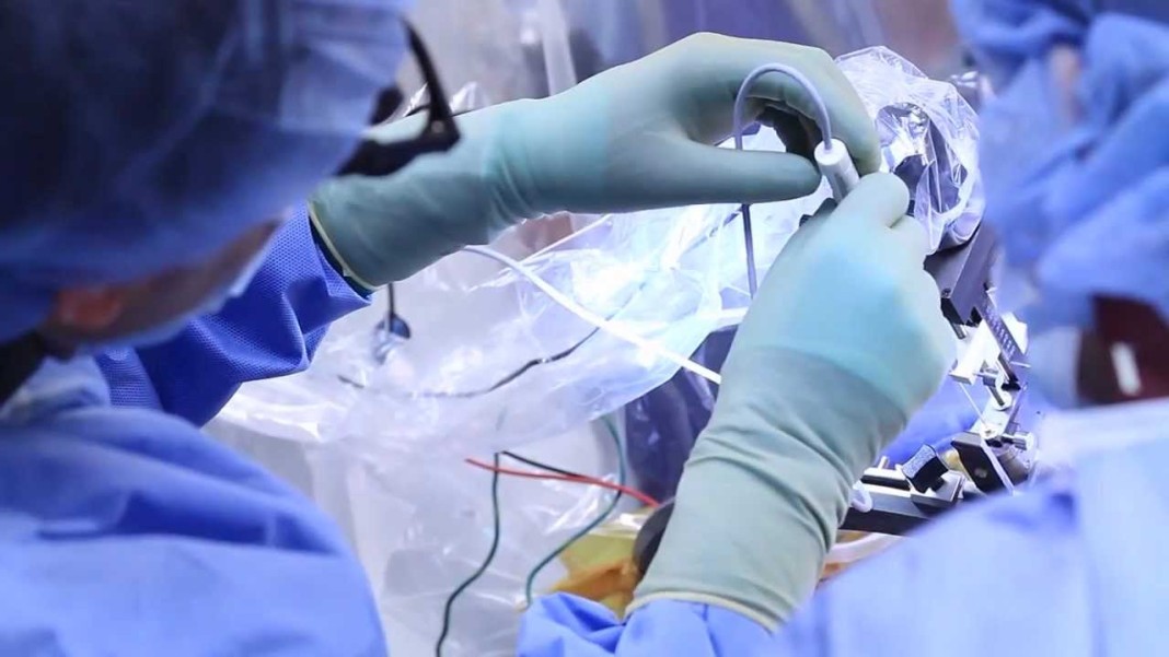 DBS: un pacemaker per curare il Parkinson