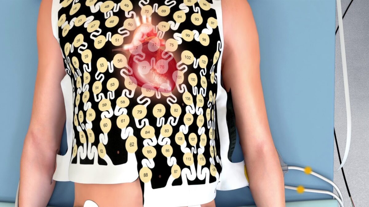 Medtronic's CardioInsightTM Mapping Vest: una “maglia” per il cuore